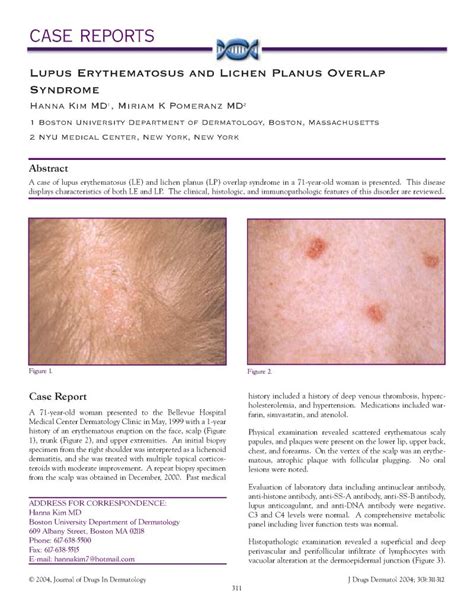 Digital Article Delivery Services On Linkedin Lupus Erythematosus And Lichen