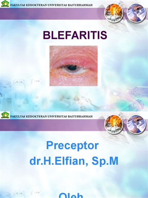 Blefaritis Pdf Sains And Matematika