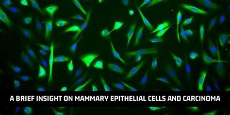 A Brief Insight On Mammary Epithelial Cells And Carcinoma Kosheeka