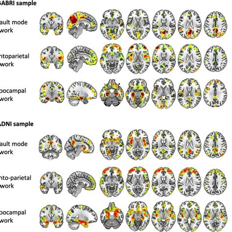 Schematic Illustration Of The Structural Covariance Network And Download Scientific Diagram