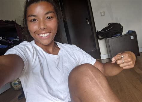 3 Years Post Op Acl And Meniscus Surgery 2 Years After Partial