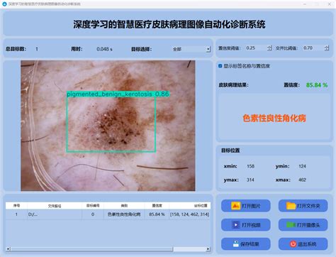 基于yolov8深度学习的智慧医疗皮肤病理图像自动化诊断系统pyqt5界面数据集训练代码 中猿创新 7zcode