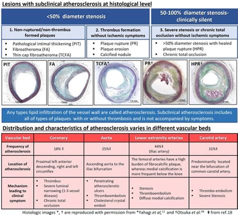 Subclinical Atherosclerosis Part 1 What Is It Can It Be Defined At
