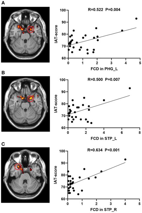 Abnormal Functional Connectivity In Cognitive Control Network Default Mode Network And Visual