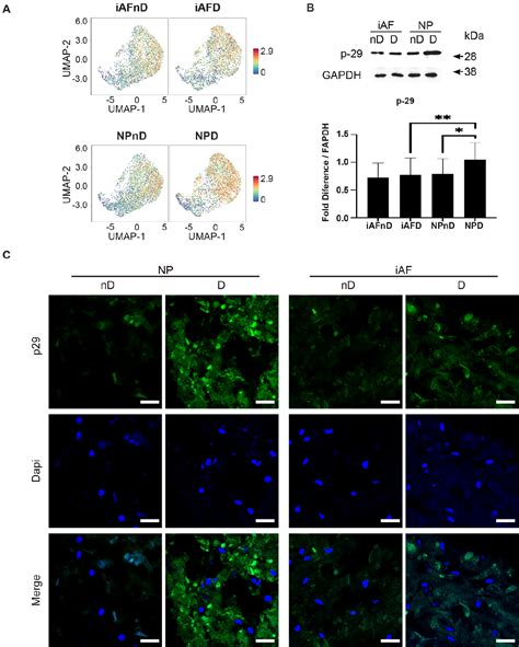 Figure 1 From Single Cell Rna Seq Analysis Of Cells From Degenerating And Non Degenerating