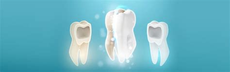 5 Different Teeth Whitening Methods For A Brighter Smile