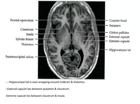 Brain Anatomy New Pdf
