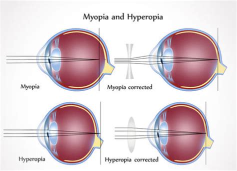 How Do Glasses Work Ask Dr Universe Washington State University