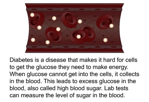 Preventing Diabetes