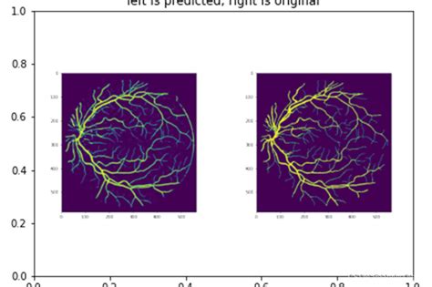 【人工智能Ⅱ】实验4：unet眼底血管图像分割unet基础实验 Csdn博客