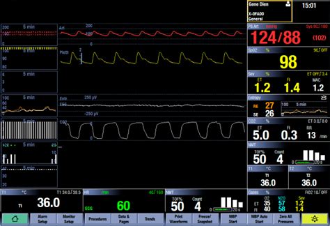 Entropy A Tool For Guiding Delivery Of Anesthesia Clinical View