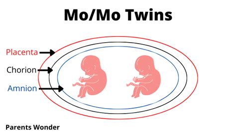 Guide To Mo Mo Twins Understanding Development And Risks
