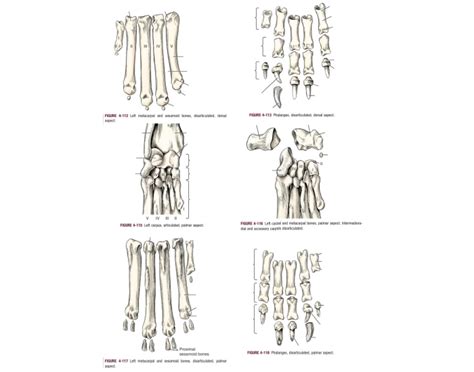 Carpal Metacarpal Phalanges Quiz