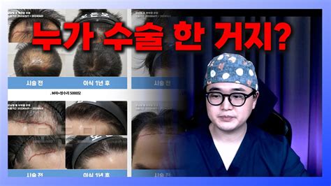 이걸 몰랐네 성형외과 비포애프터의 진실 Youtube