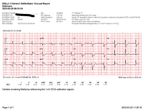 The Hospital Isnt Even Surprised Anymore When Patients Show Up With Me Handing Them Ekgs Like