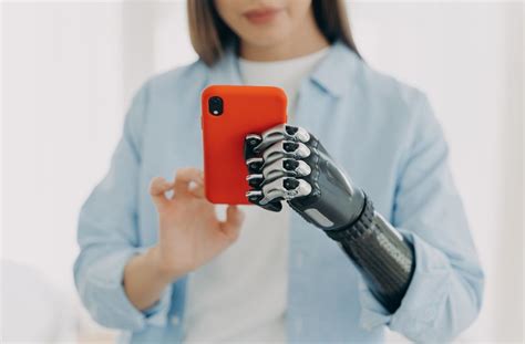 Upper Limb Prostheses Bridging The Sensory Gap