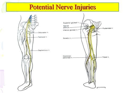 PPT POSITIONING IN OPERATING THEATRE PowerPoint Presentation Free Download ID 225230