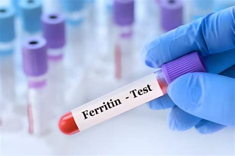 Normal Ferritin Levels Chart For Women Age Wise Essential Ferritin