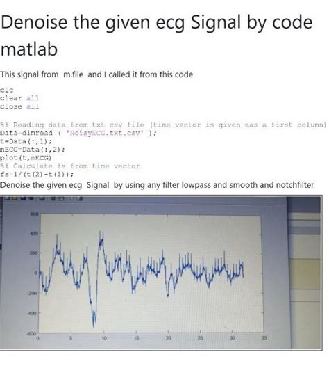 Denoise The Given Ecg Signal By Code Matlab This