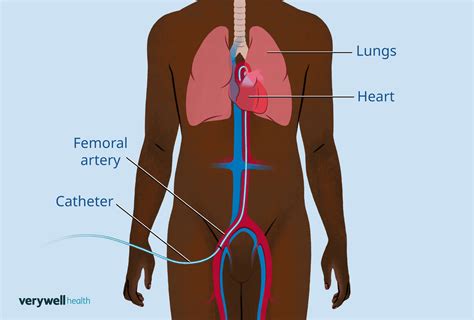 Angiogram Test Purpose And Procedure