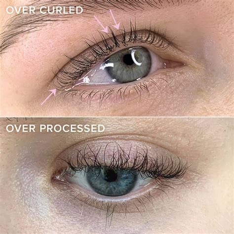 Frequently Asked Questions And Answers On Lash And Brow Lift