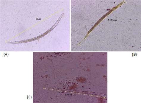 A Larva L3 Infectiva De Trichostrongylus Sp Región Posterior Con Download Scientific Diagram