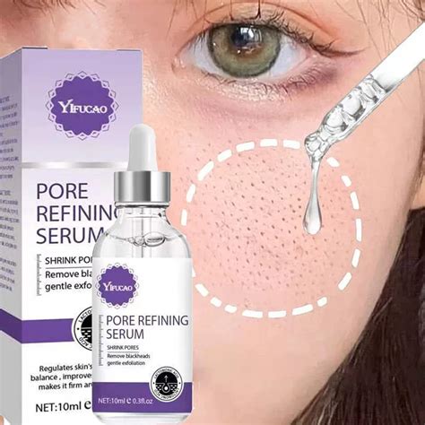 홈 제품 피드백