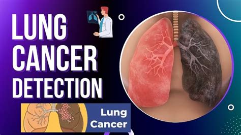 Github Projects Developer Lung Cancer Detection System Using Machine Learning This Project