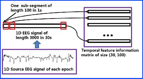 Figure 2 From Time Frequency Convolutional Neural Network For Automatic