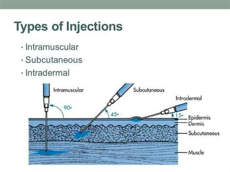Pin On Injection Subcutaneous Injection Dermis Injections