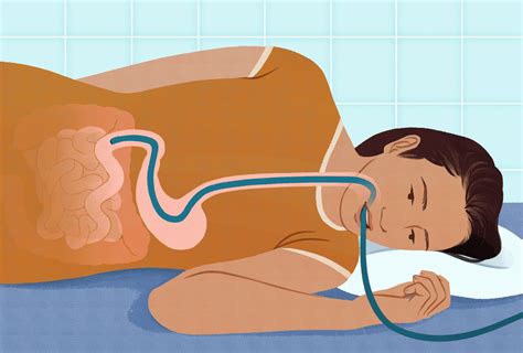 Ercp Procedure Digestion Diagnosis Treatment Results 58 Off