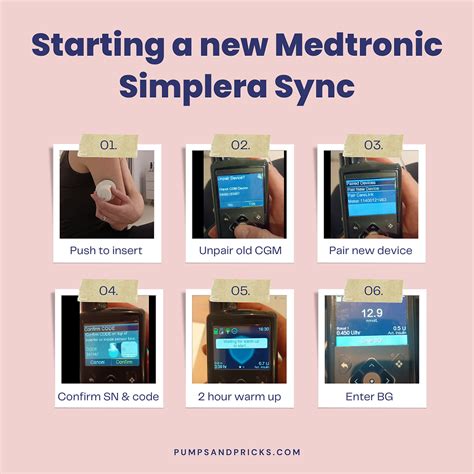 First Impressions Of The Simplera Sync 2 Weeks In