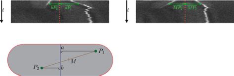Kymographs Upper Left Kymograph Representing The Movement Of The