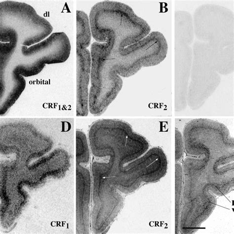 Corticotropin Releasing Factor1 Crf 1 And Crf 2 Receptor Binding And