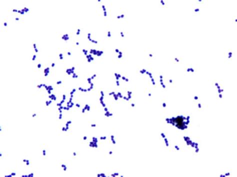 Gram Negative Rods In Clusters