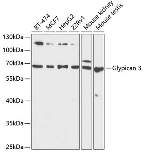 Glypican 3 Polyclonal Antibody Pa5 109771