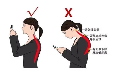 脖子後面的「富貴包」，究竟是怎麼長出來的？ 每日頭條