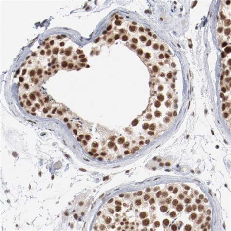 Anti Bub3 Pab Catalog No Atl Hpa003601