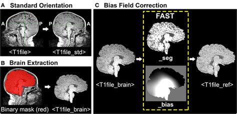 Structural Magnetic Resonance Imaging Mri Data Preprocessing Download Scientific Diagram