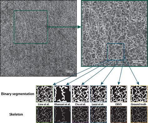 Optimization Based Vessel Segmentation Pipeline For Robust Quantification Of Capillary Networks