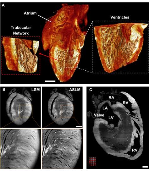 Light Sheet Imaging To Reveal Cardiac Structure In Rodent Hearts Scientific Article Protocol