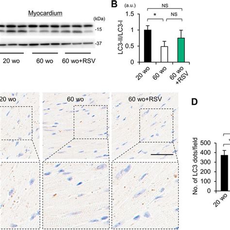 Resveratrol Suppresses Aging Related Cardiomyocyte Hypertrophy A