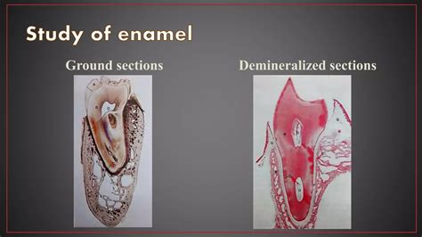 1st Bds Lecture On Tooth Enamel Pptx