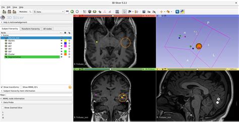 Merge Models With Volume Support 3d Slicer Community
