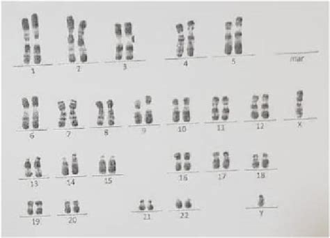Karyotyping Showing An Xy Genotype Download Scientific Diagram