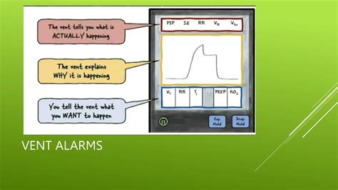 Ventilator Troubleshooting In Icu Hospitalpptx