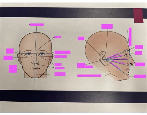Reference Points And Radiographic Lines Quiz
