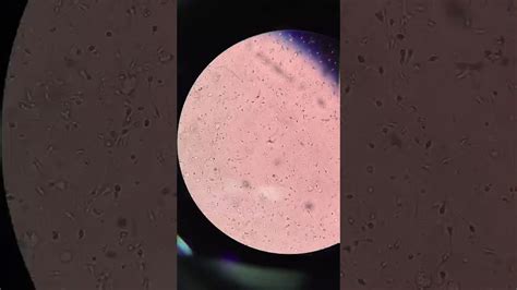 Tampak Sperma Dibawah Mikroskop YouTube