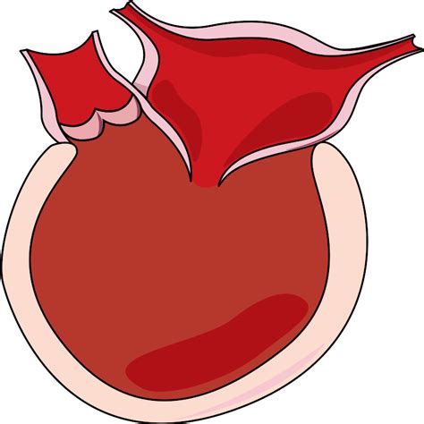 Systolic Dysfunction Figure Science Figures
