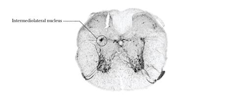Anatomy Of The Sympathetic Nervous System Deranged Physiology